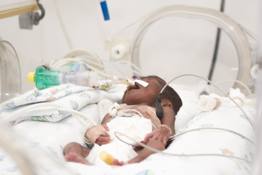 8 Reasons for a Premature Birth - Buffalo Healthy Living Magazine