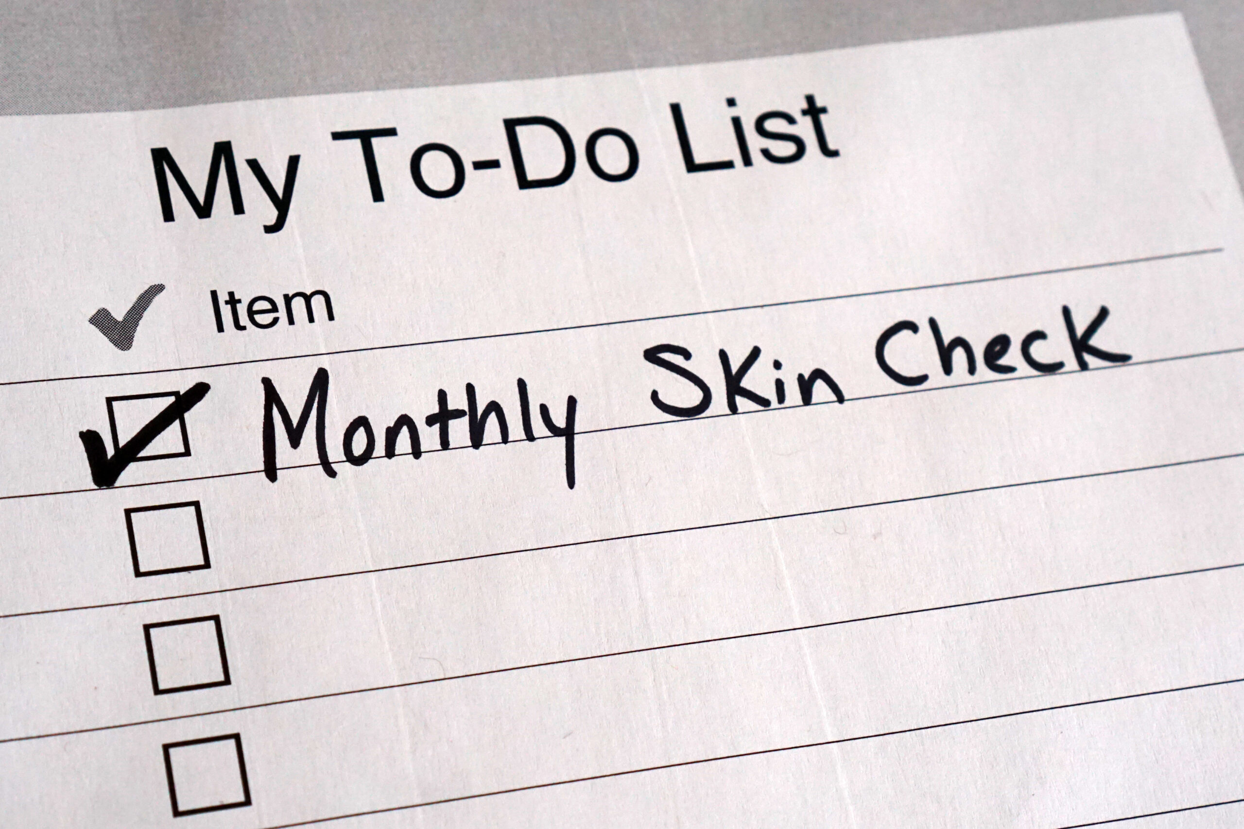 To do list reminder for monthly skin check for skin cancer scree ...