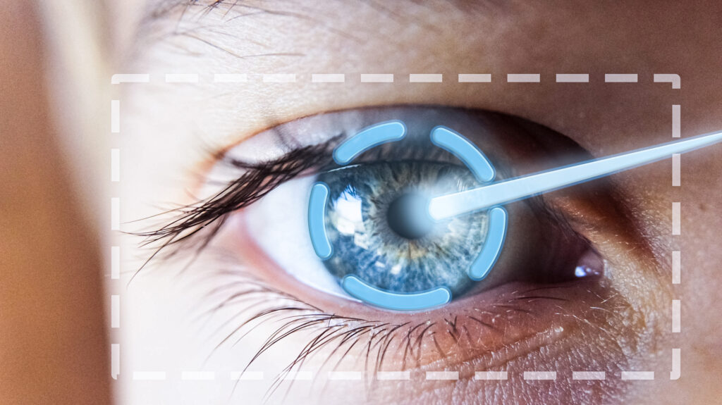 Close Up Blue Eye Laser Surgery - Buffalo Healthy Living Magazine