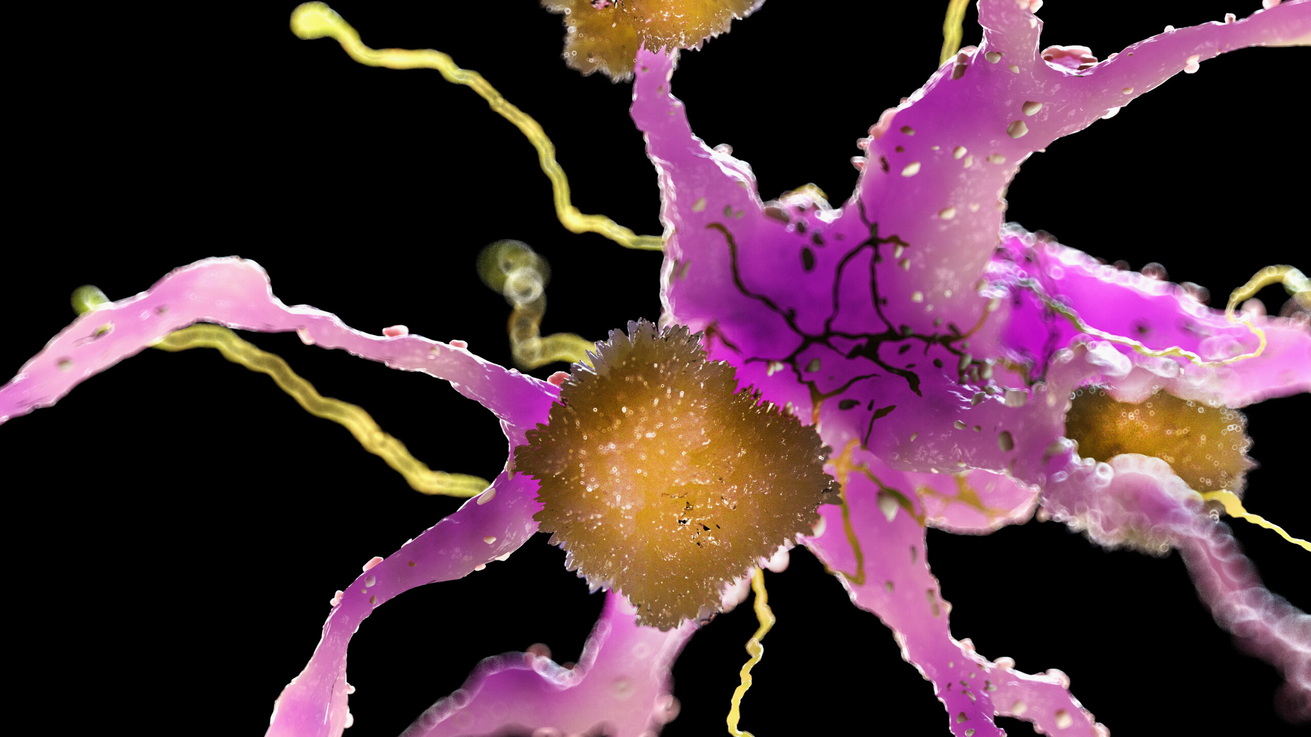 3d rendered medically accurate illustration of amyloid plaques o ...