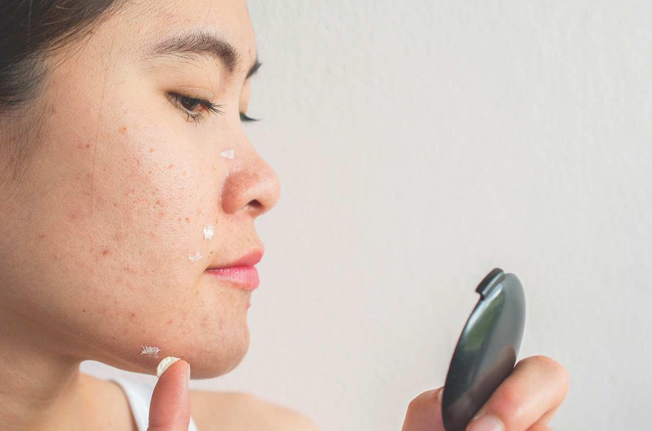 Remedies for Common Skin Issues - Buffalo Healthy Living Magazine