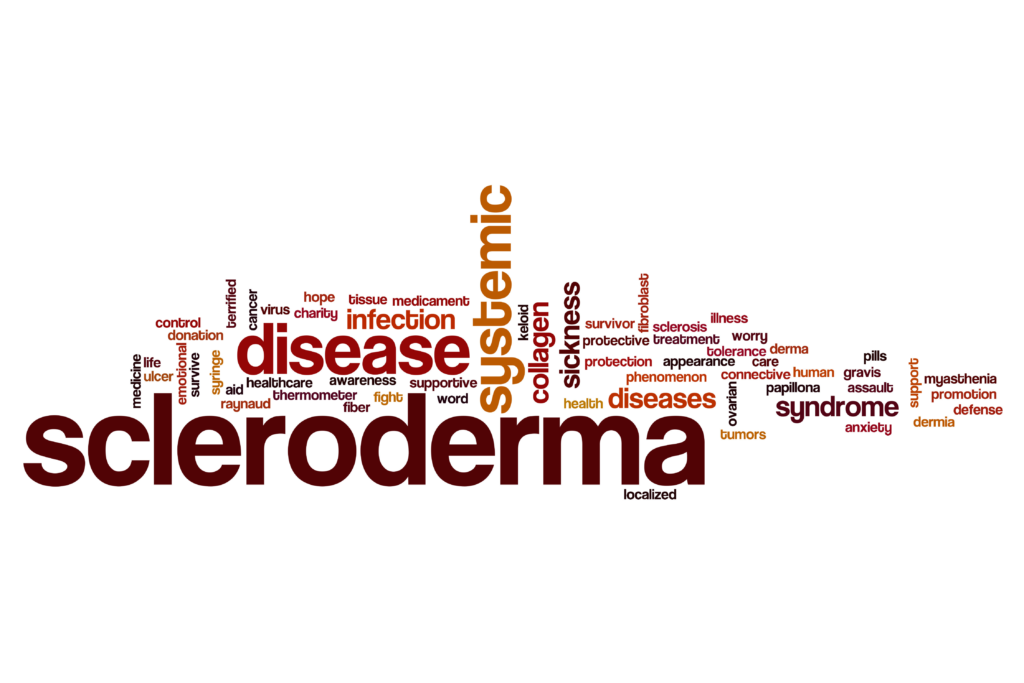What Is Scleroderma - Buffalo Healthy Living Magazine